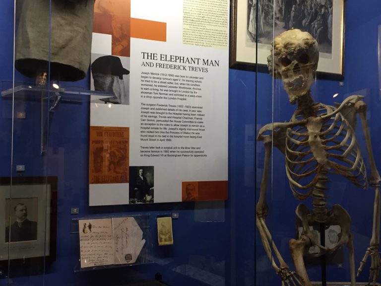 Five Fascinating Medical Objects at the Royal London Hospital Museum ...